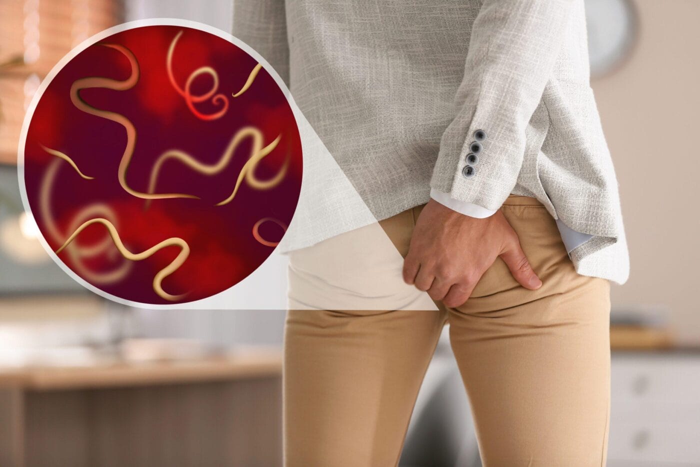 Takto zistíte, že máte v tele parazitov: Skryté príznaky, o ktorých ani ...