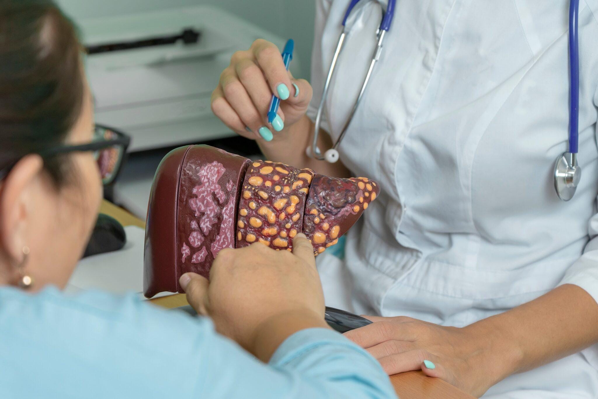 Najlepší liek na pečeň - očista, vitamíny, detox - Vmagazin.sk