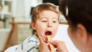 Mandľové kamene – čo to je, príčiny a možnosti liečby - Vmagazin.sk